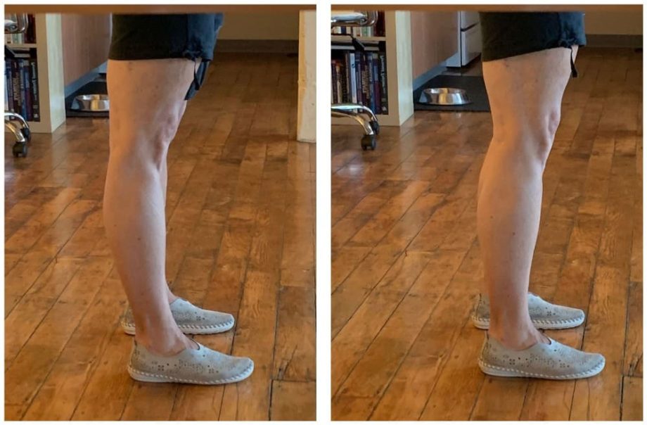 Hypermobility Part 2: Embracing “Wonky” Joints - Mind 2 Body Fit