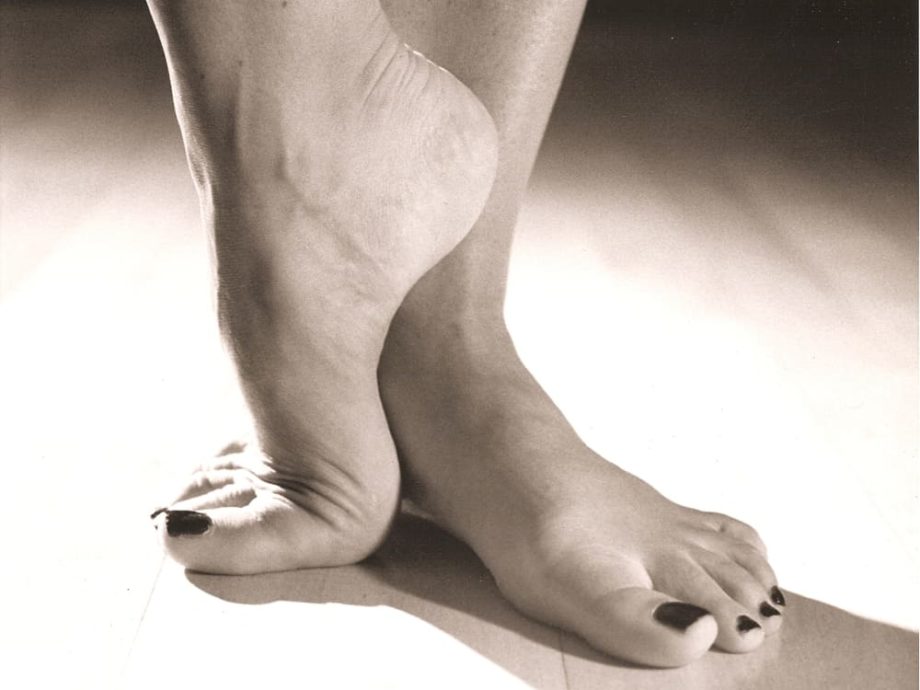 Hypermobility Part 2: Embracing “Wonky” Joints - Mind 2 Body Fit